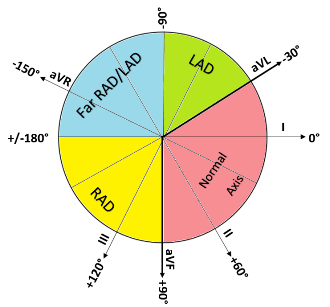 Determining Cardiac Axis – The Student Physiologist