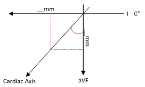 Determining Cardiac Axis – The Student Physiologist