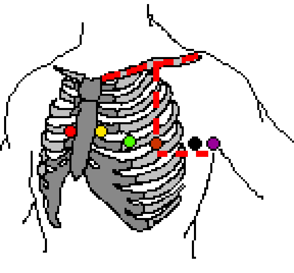 The ECG Leads, Polarity and Einthoven’s Triangle – The Student Physiologist