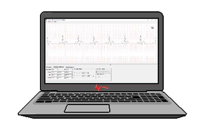 Review: simECG: ECG Simulator v1.186 – The Student Physiologist