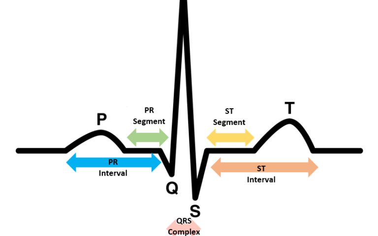 Q Waves – The Student Physiologist
