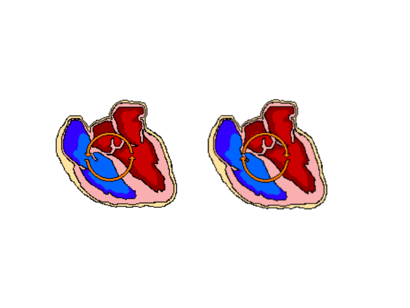 AVNRT and AVRT – The Student Physiologist
