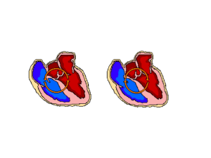 AVNRT and AVRT – The Student Physiologist