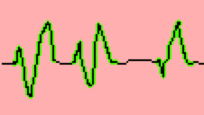 Week 3: The Learning Curve of Holter Analysis – The Student Physiologist