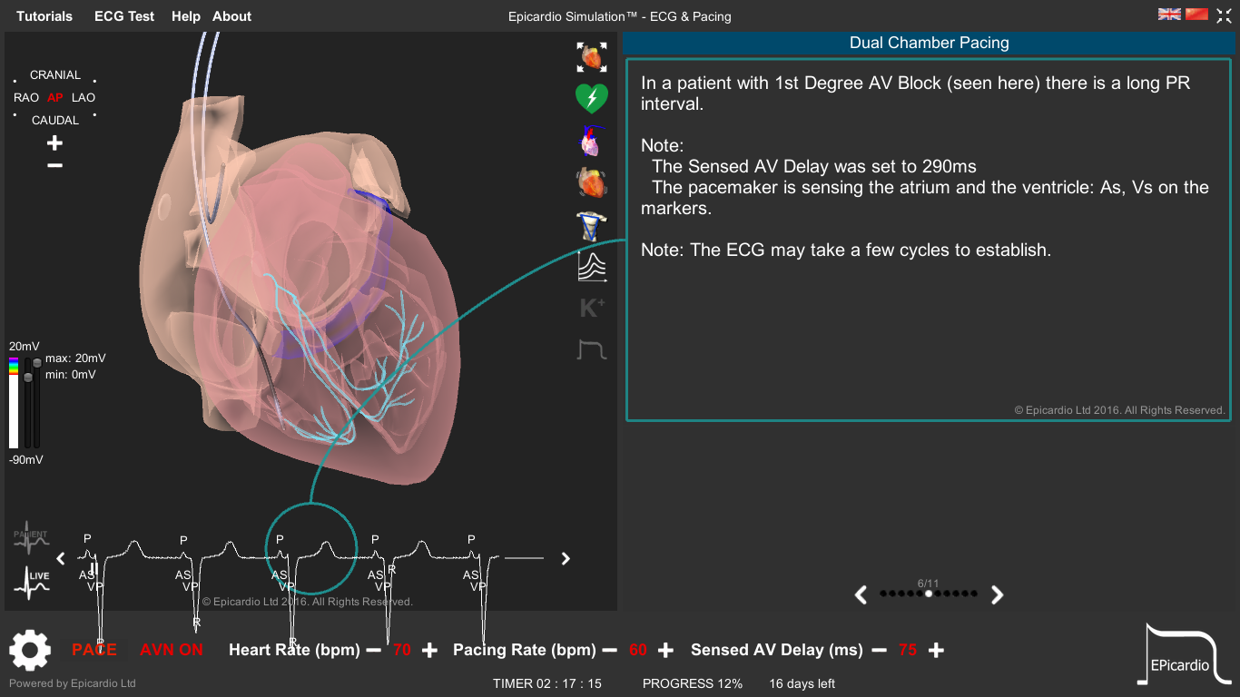 pacemakers – The Student Physiologist