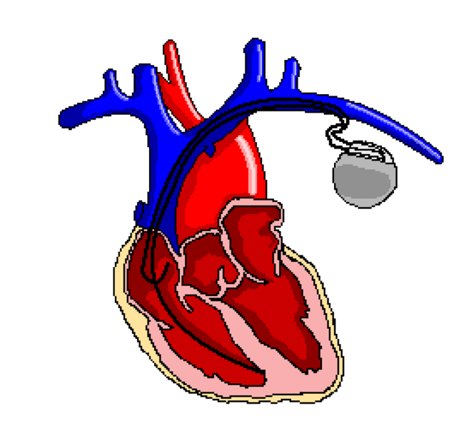 Pacemaker Components – The Student Physiologist