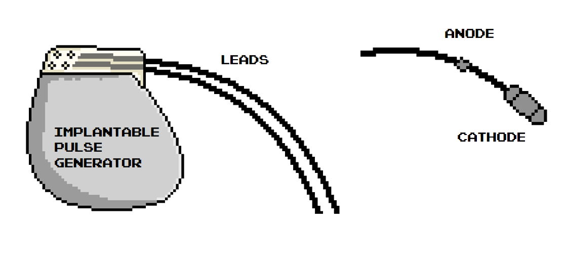 Pacemaker Components – The Student Physiologist