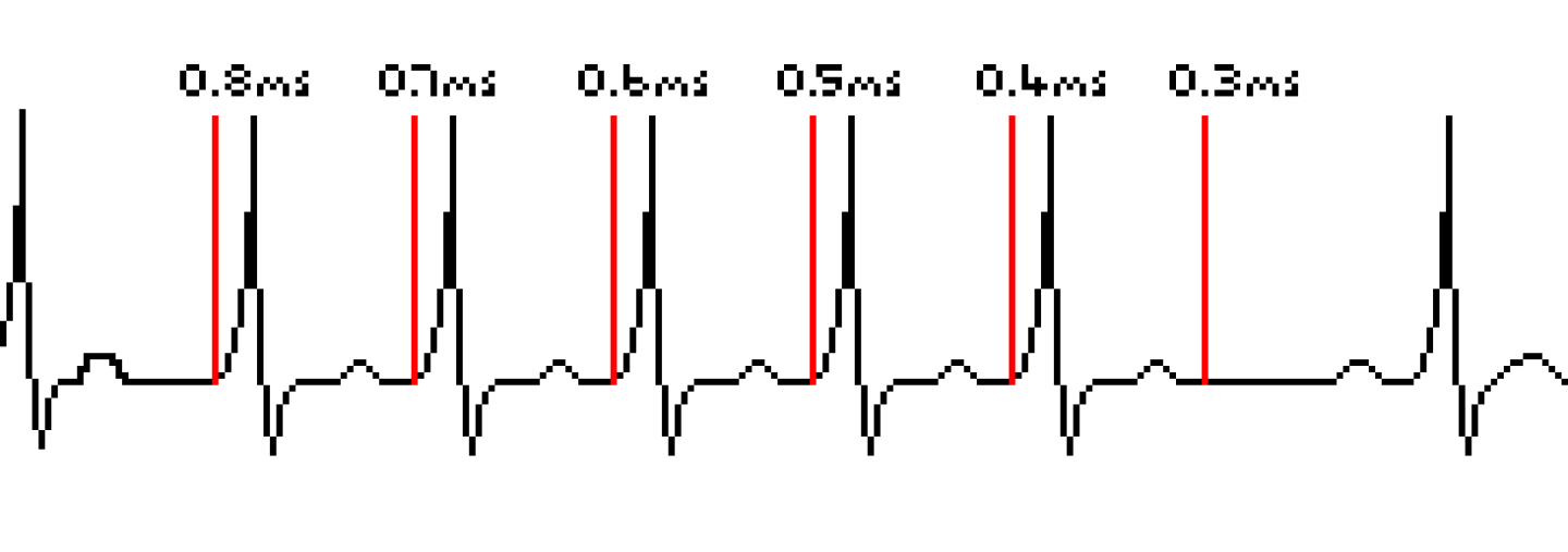 Thresholds – The Student Physiologist