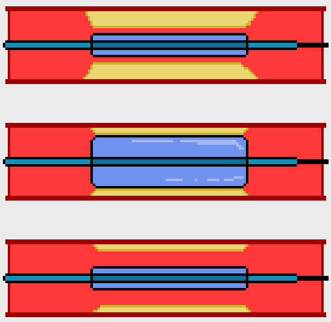 Balloons – The Student Physiologist